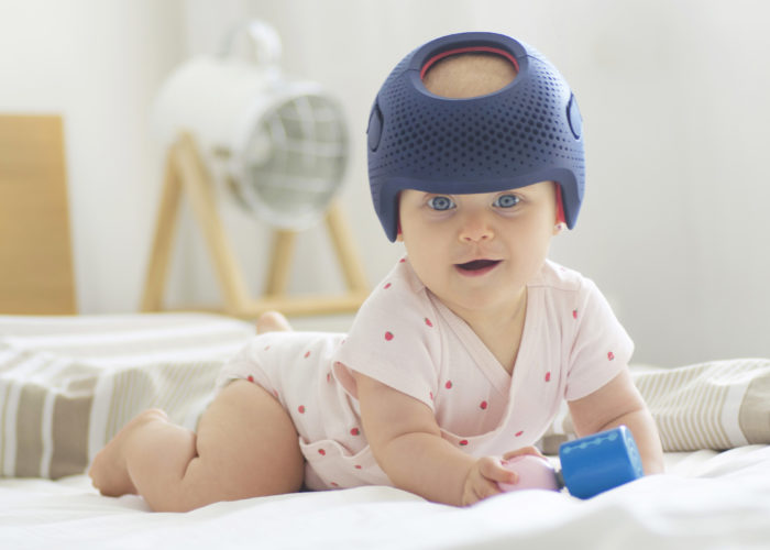 Ortopedia Ortosan | PLAGIOCEFALIA